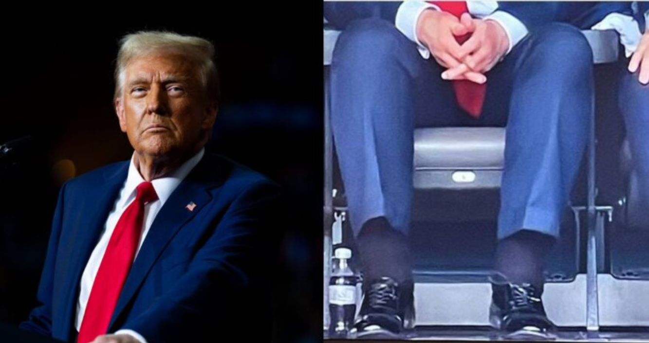 Donald Trump’s Swollen Ankles Grab Spotlight During Meeting with ...